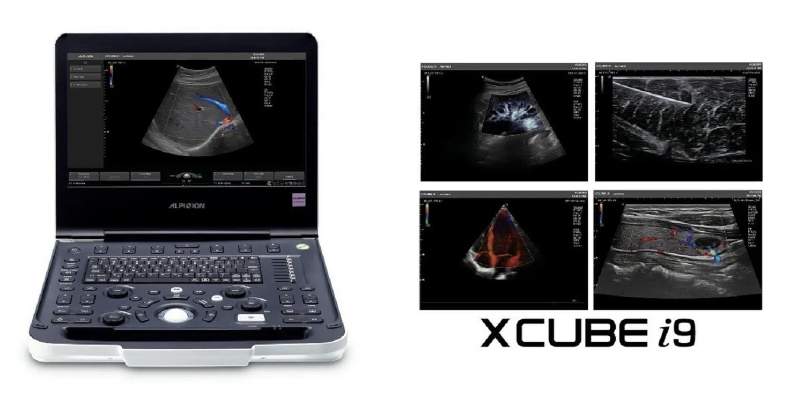 Discover the Power: 8 Reasons Why the X-CUBE i9 by Alpinion is Your Ultimate Diagnostic Ally ...